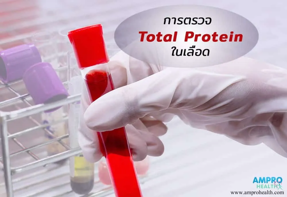 การตรวจ Total Protein บ่งบอกอะไร - AM Pro Health